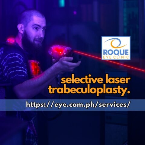 Selective Laser Trabeculoplasty | One Eye (PF only) - ROQUE Eye Clinic ...