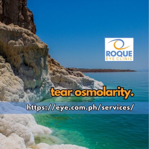 TEAR OSMOLARITY - ROQUE Eye Clinic | Eye.com.ph