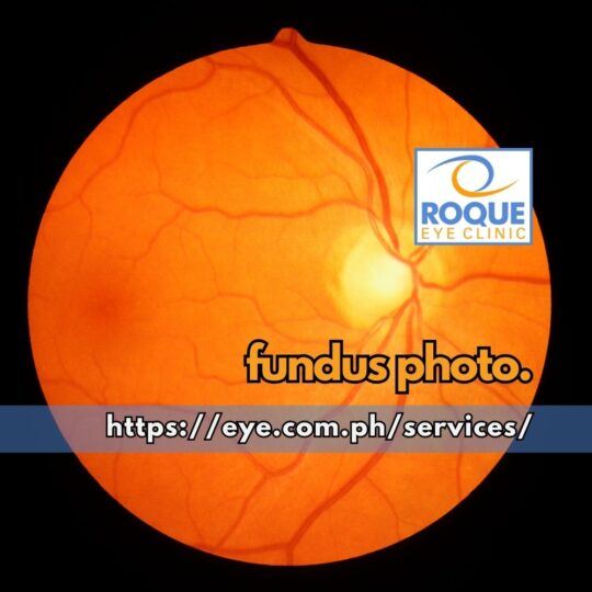 Fundus Photo - ROQUE Eye Clinic | Eye.com.ph