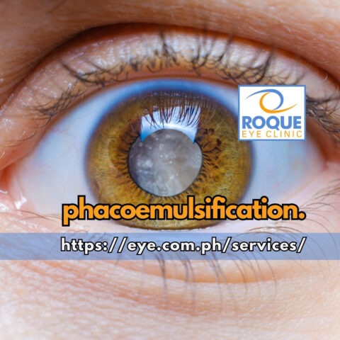 Phacoemulsification (Minimally Invasive Cataract Surgery) | One Eye (PF ...