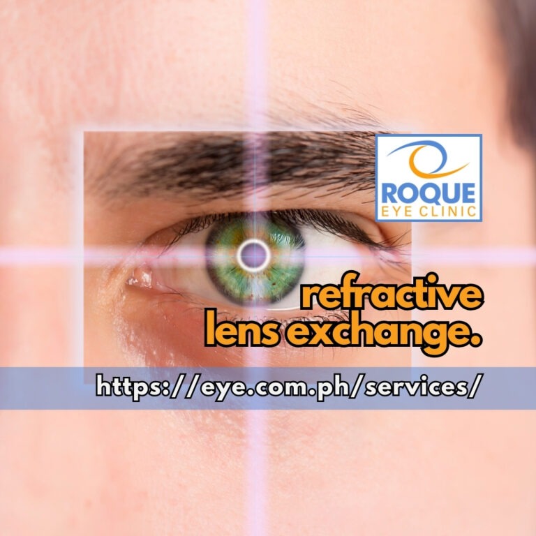Refractive Lens Exchange (RLE) | One Eye (PF only) - ROQUE Eye Clinic ...