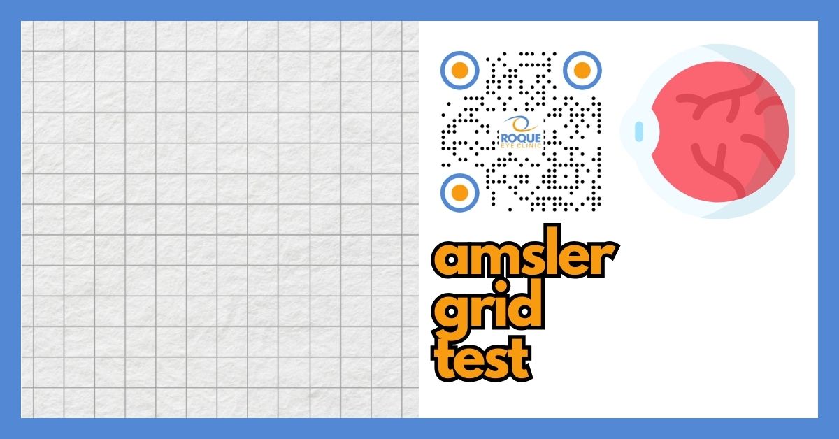 Amsler Grid Monitoring: A Simple Home Check for Central Vision Changes