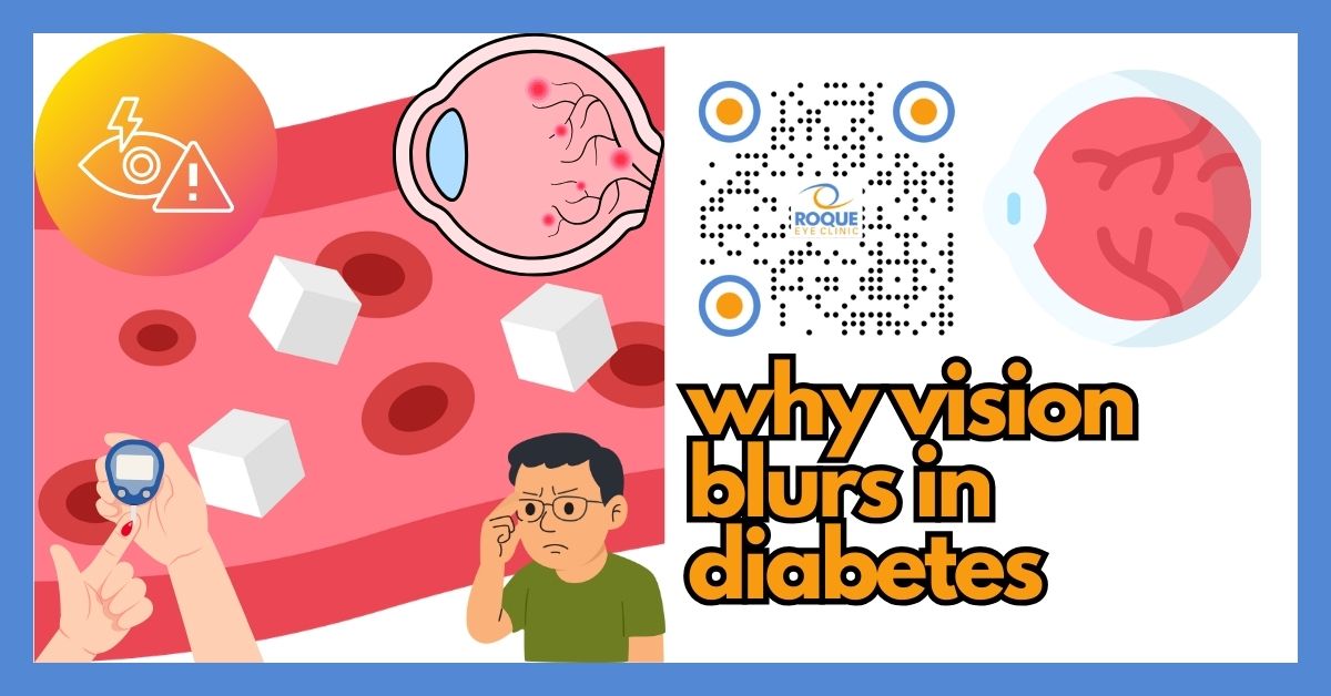 Why Vision Blurs with Diabetes (Temporary Blur vs Retinal Damage)